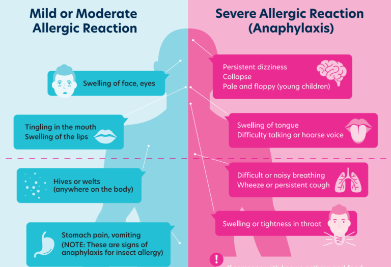 Welcome to Allergy & Anaphylaxis Australia