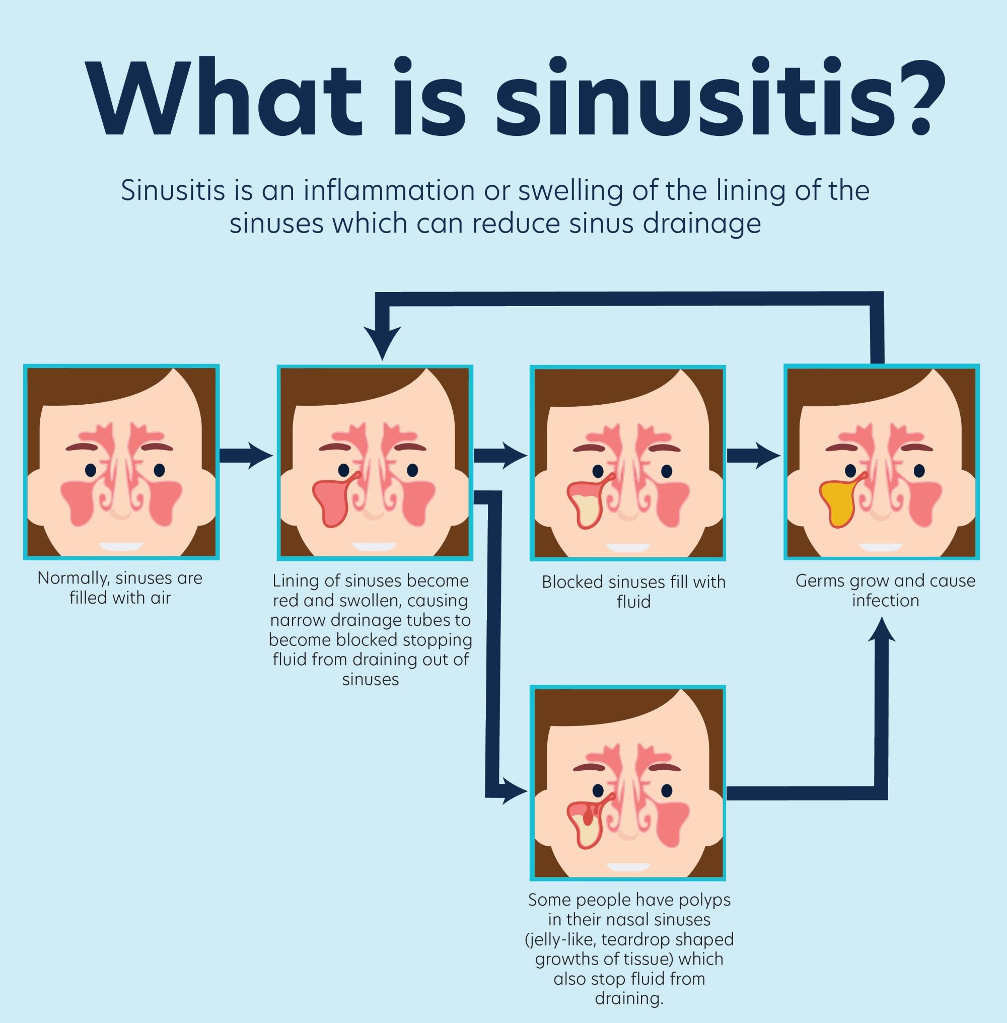 Allergic rhinitis and chronic rhinosinusitis comparison - Allergy & Anaphylaxis Australia